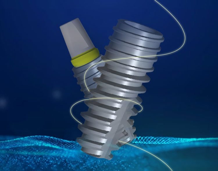 Tooth Implant Manufacturer in Goa - Pivot Implants | Best Dental Implants